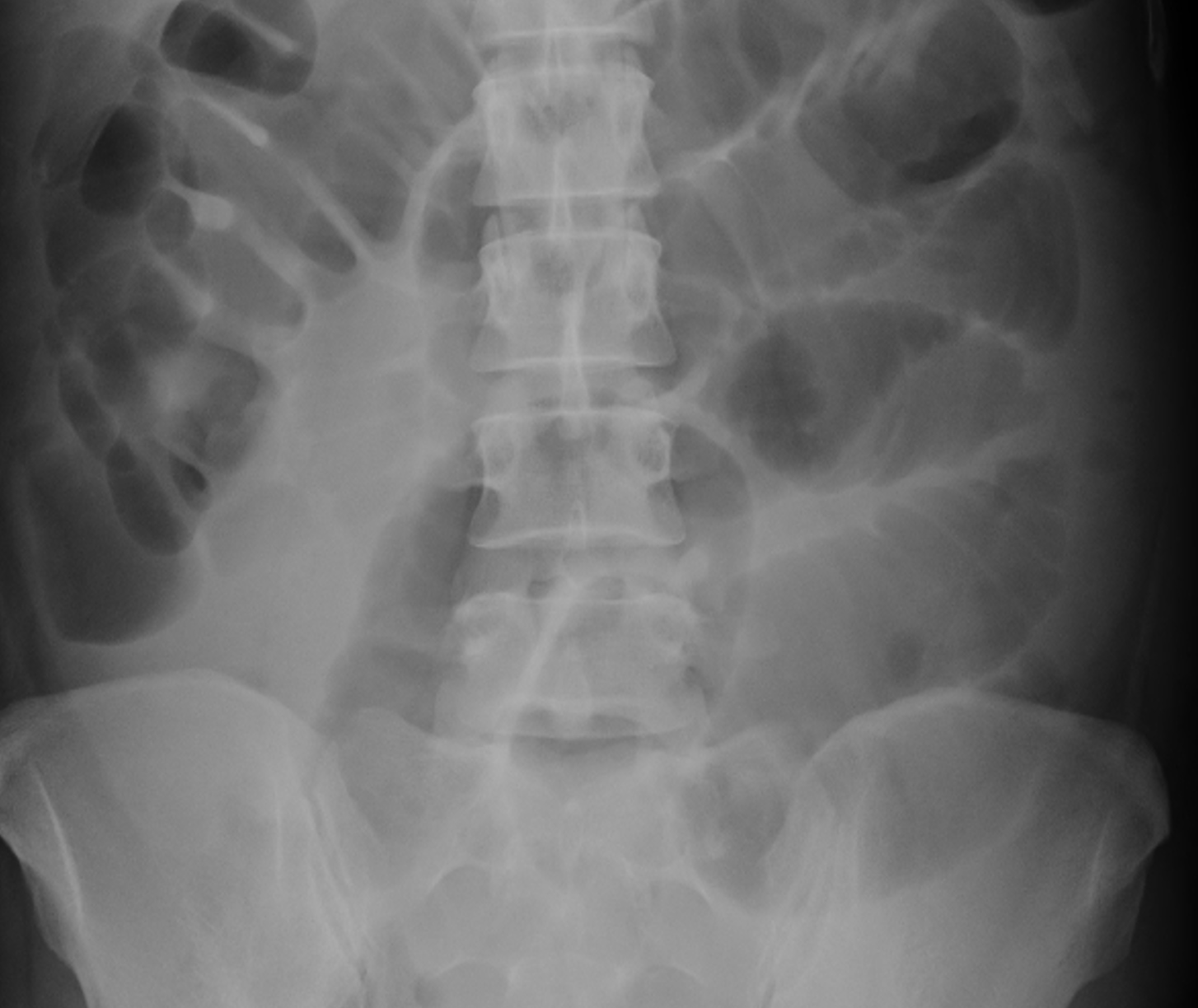 Learn More - Uncle Jimmy Radiology